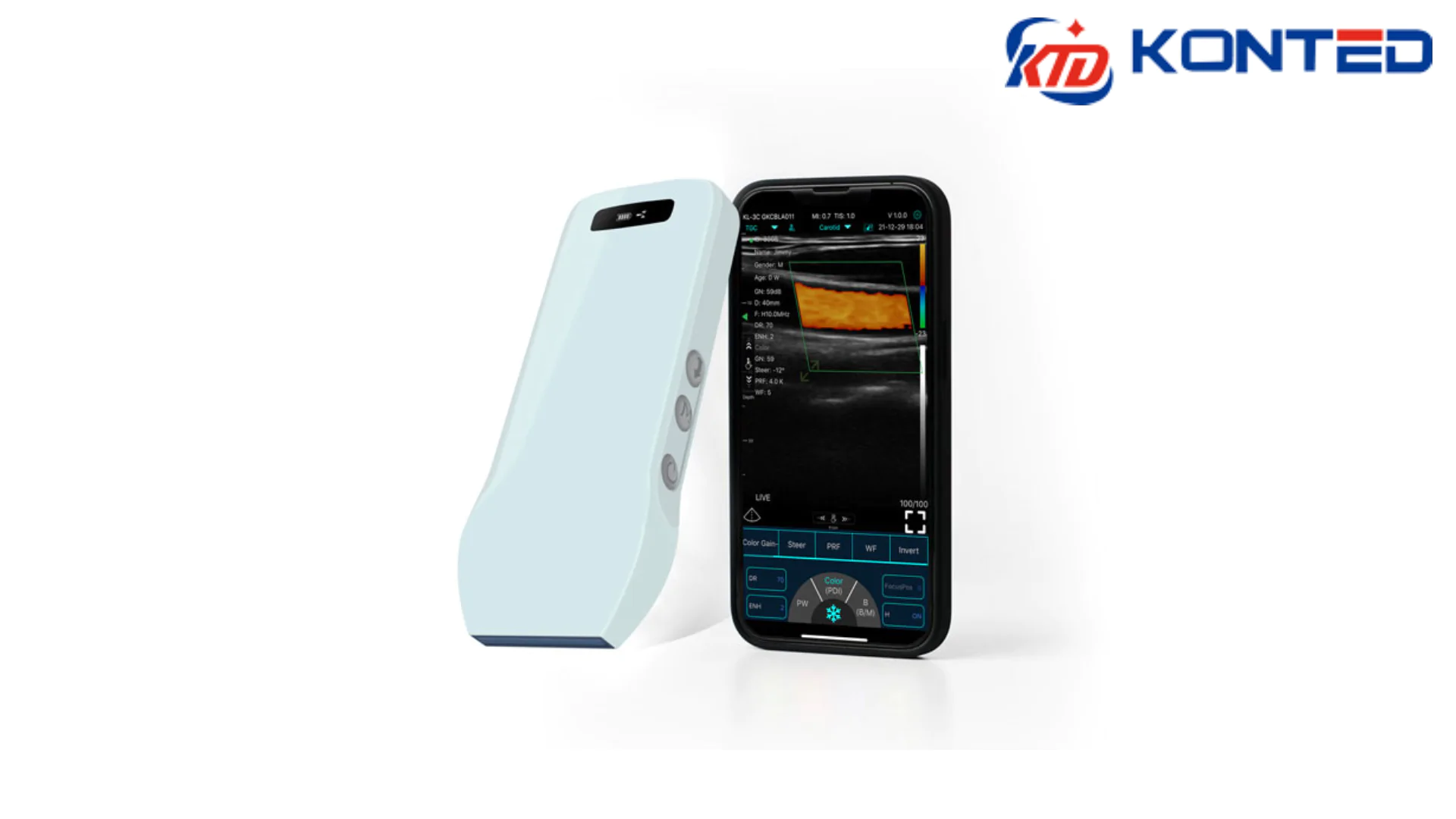 KONTED C10CX LINEER HANDHELD WIRELESS ULTRASOUND | Denizler Medikal